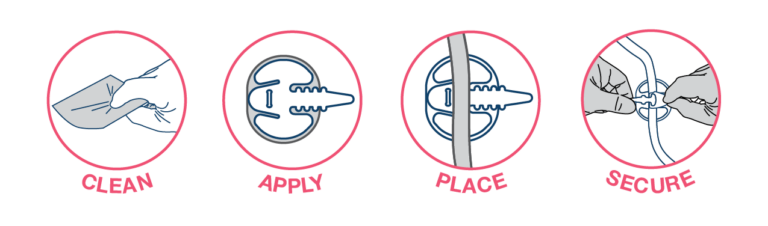 CINCH® Tube Securement Device & Supplies - AMT