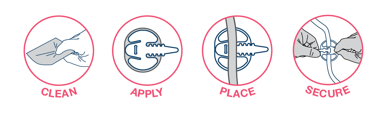 CINCH® Tube Securement Device & Supplies - AMT