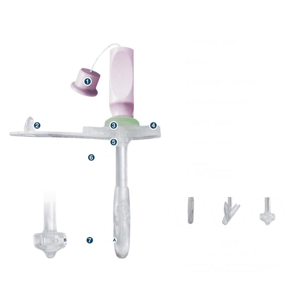 MiniONE® Capsule Non-Balloon Button G Tube, Low Profile - AMT