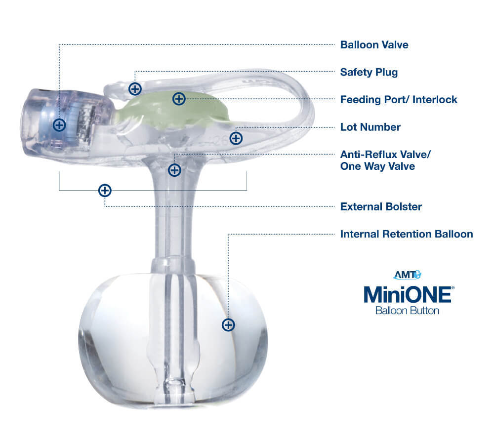 MiniONE® Balloon Button G Tube, Low Profile - AMT