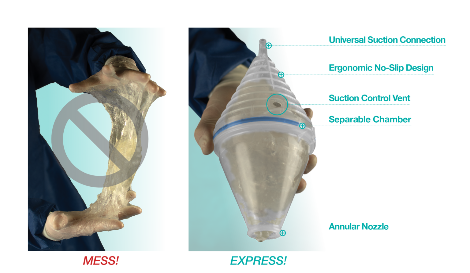 Explant Express® | Applied Medical Tech